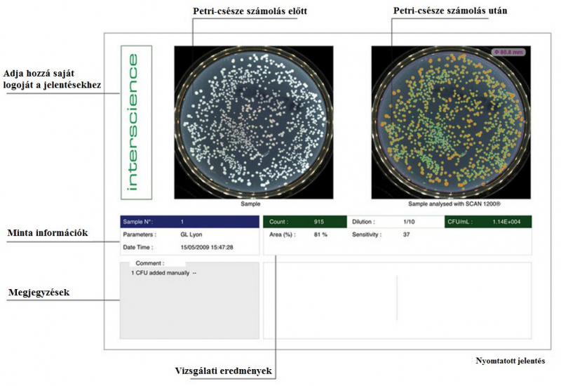 Interscience Scan 4000 Ultra HD automatikus telepszámláló